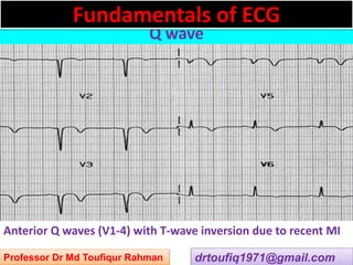 Approach to a patient with Q wave abnormality in ECG | PPSX