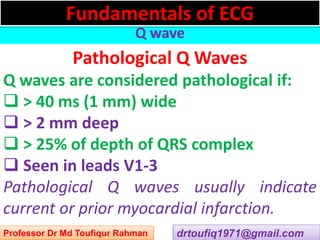 Abnormal Q Wave