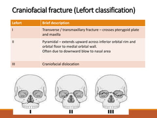 Head injury finalized | PPT