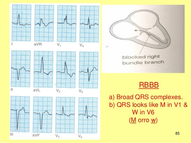 ECG in GP By Prof.Dr.R.R.Deshpande