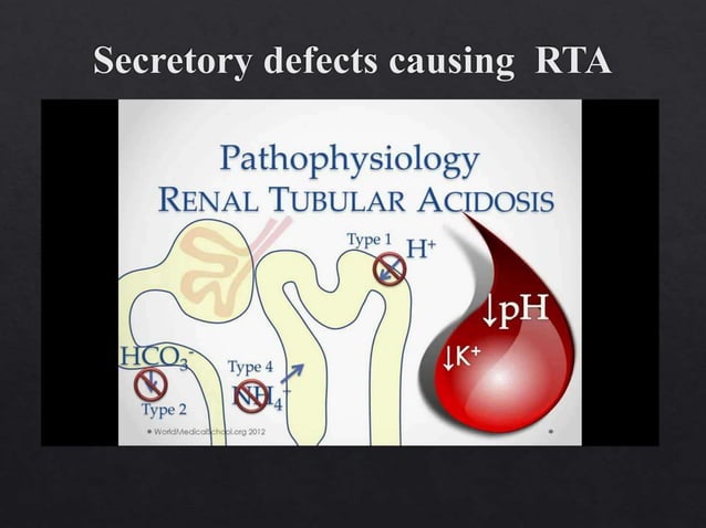 Renal Tubular Acidosis | PPT