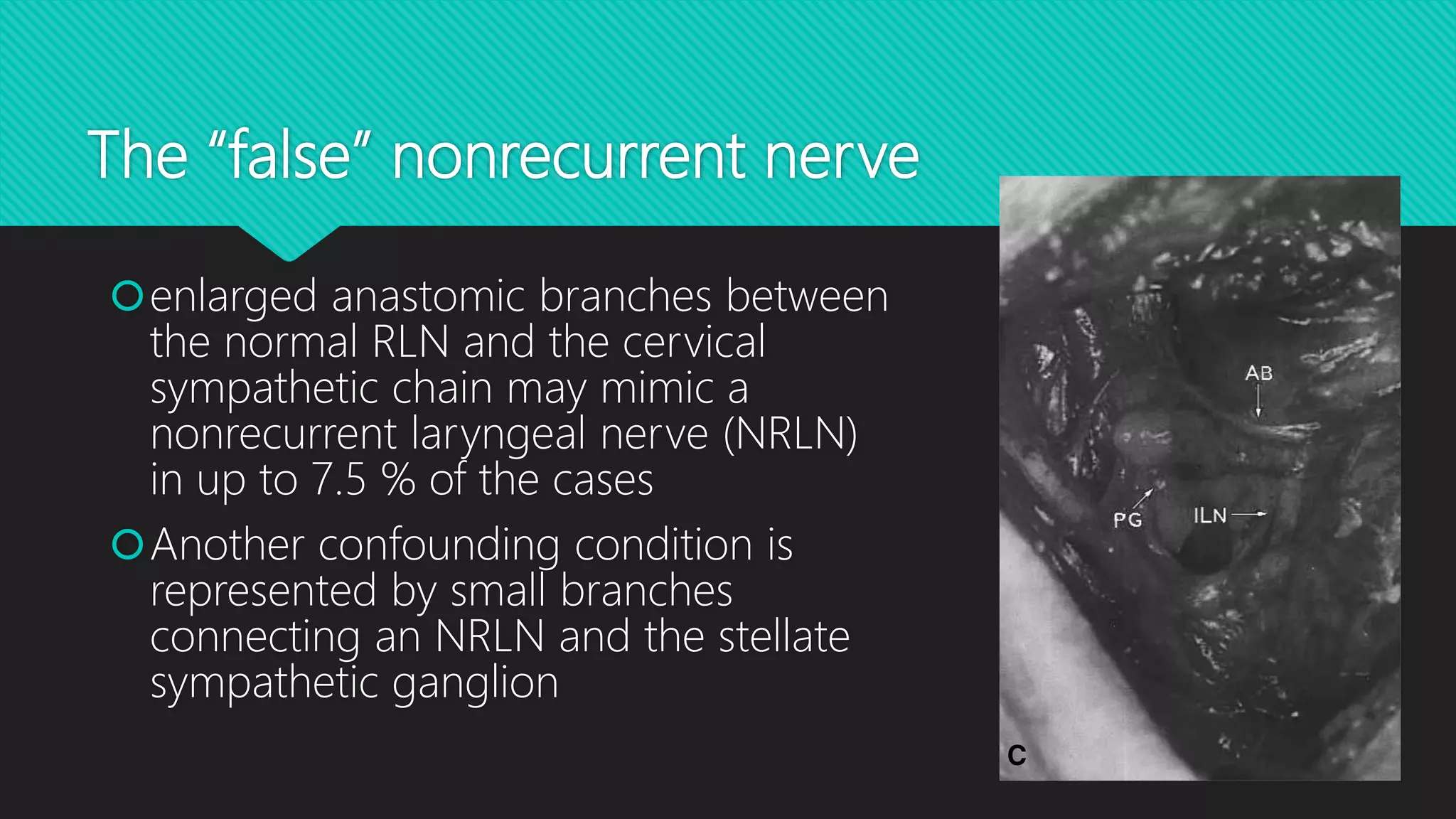 Recurrent laryngeal nerve | PPTX