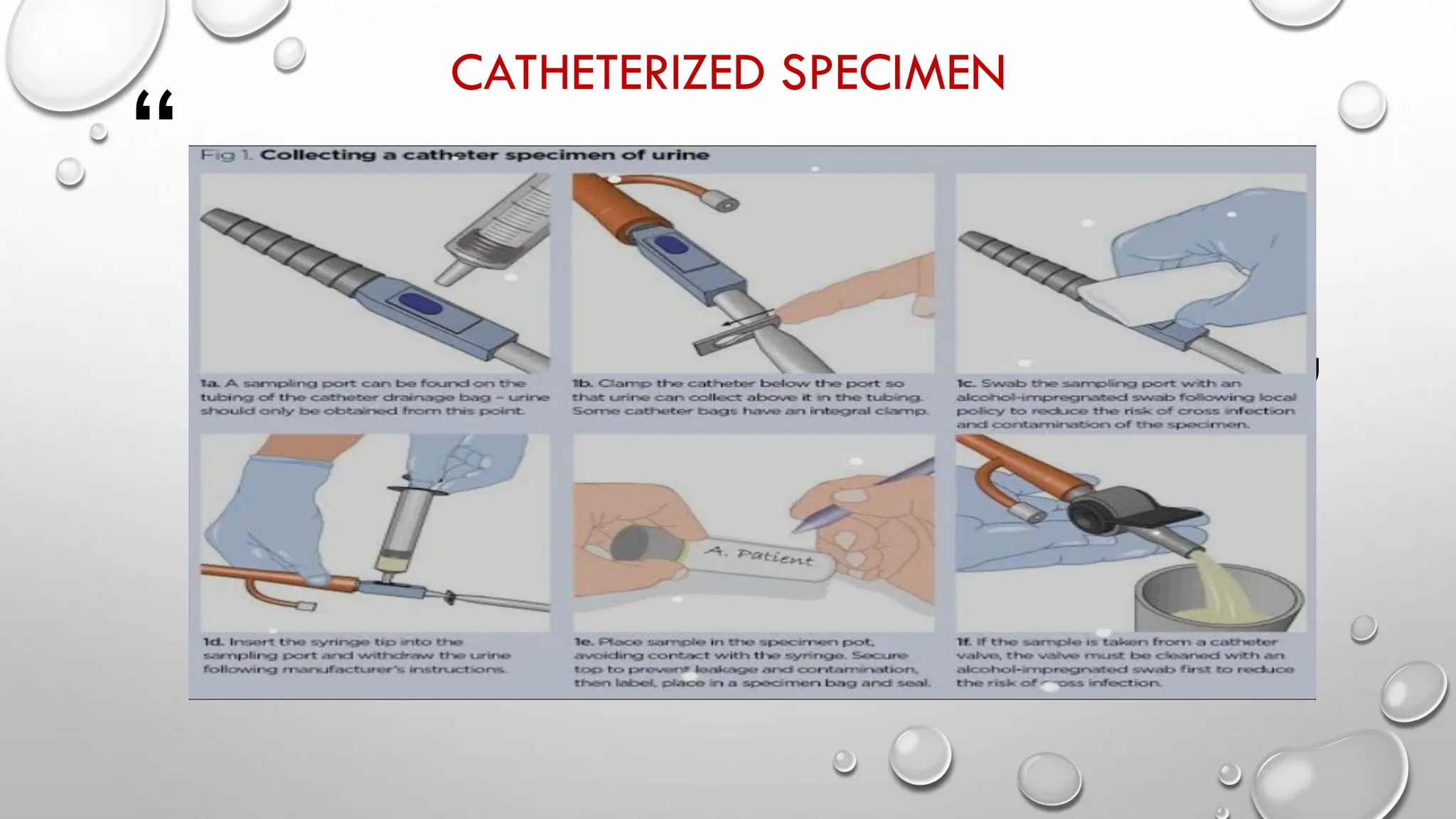 CLT - Urine Sample collection and processing | PDF