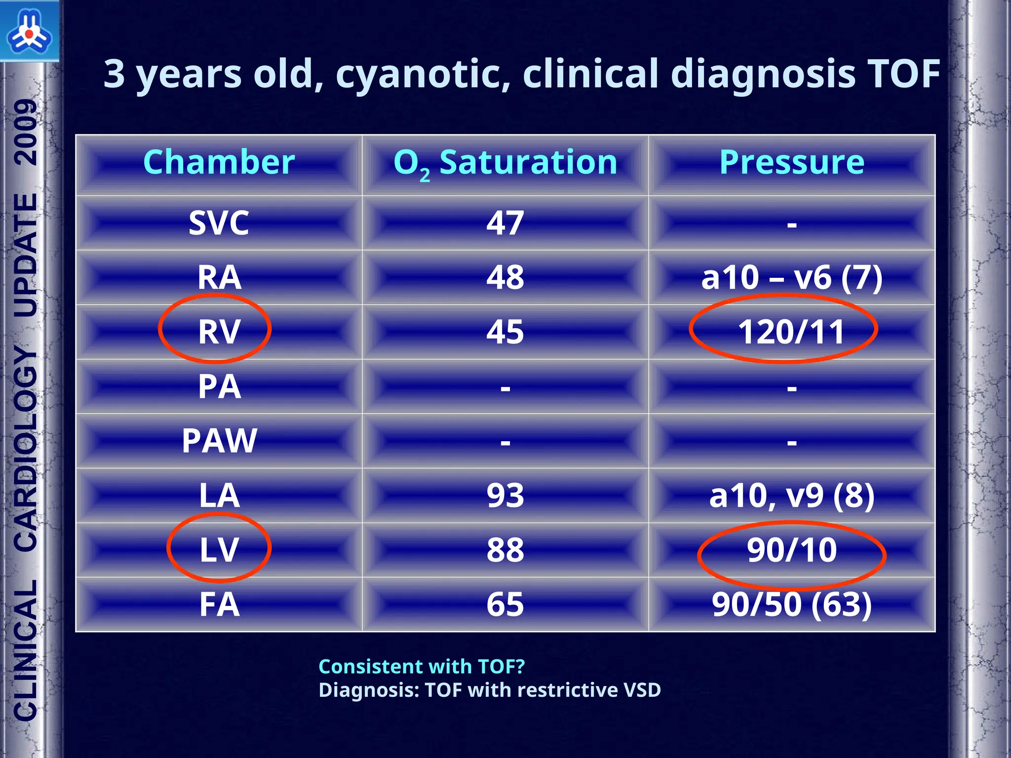 R. Suresh Kumar-HEMODYNAMIC AND OXIMETRIC STUDY.ppt