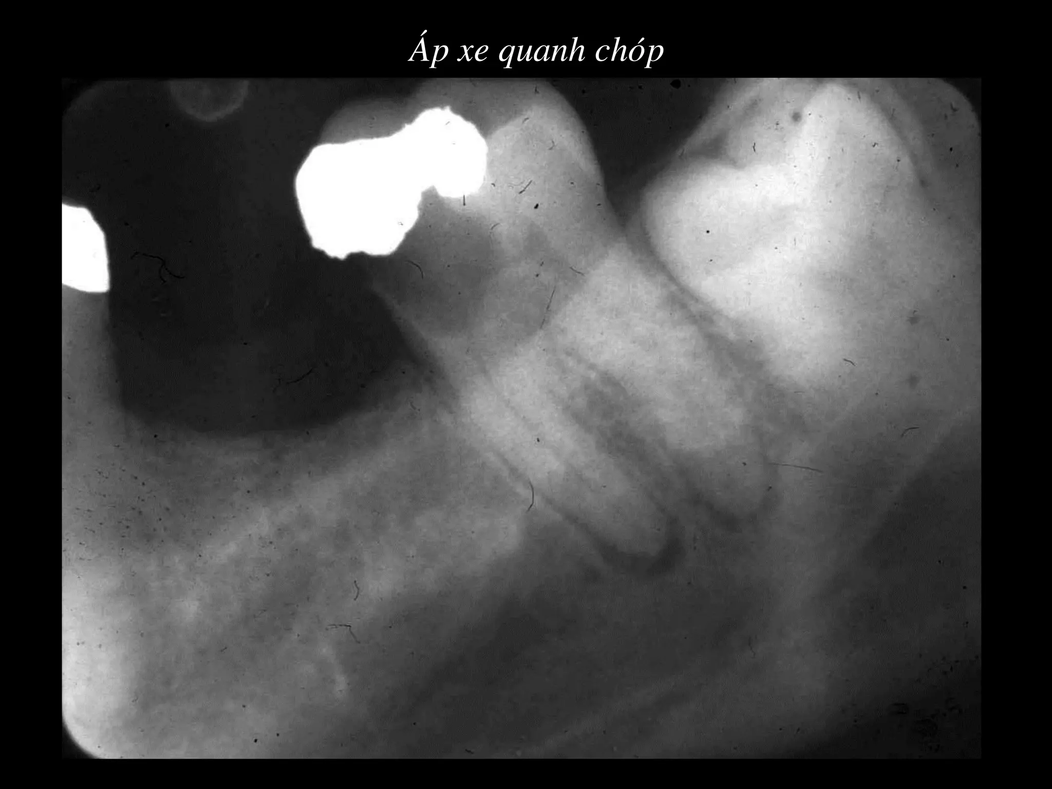 pulpal and periapical pathology. | PDF