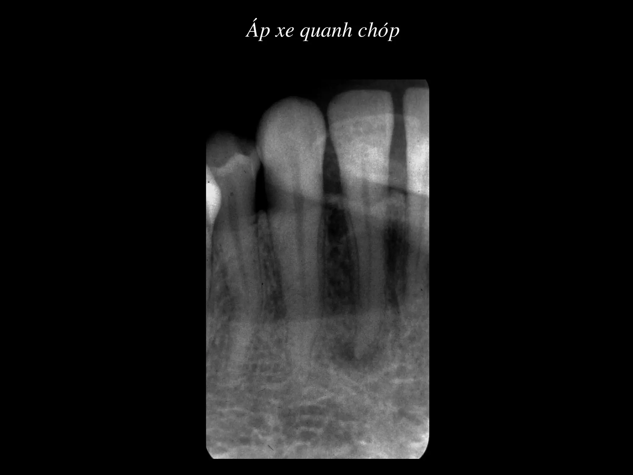 pulpal and periapical pathology. | PDF