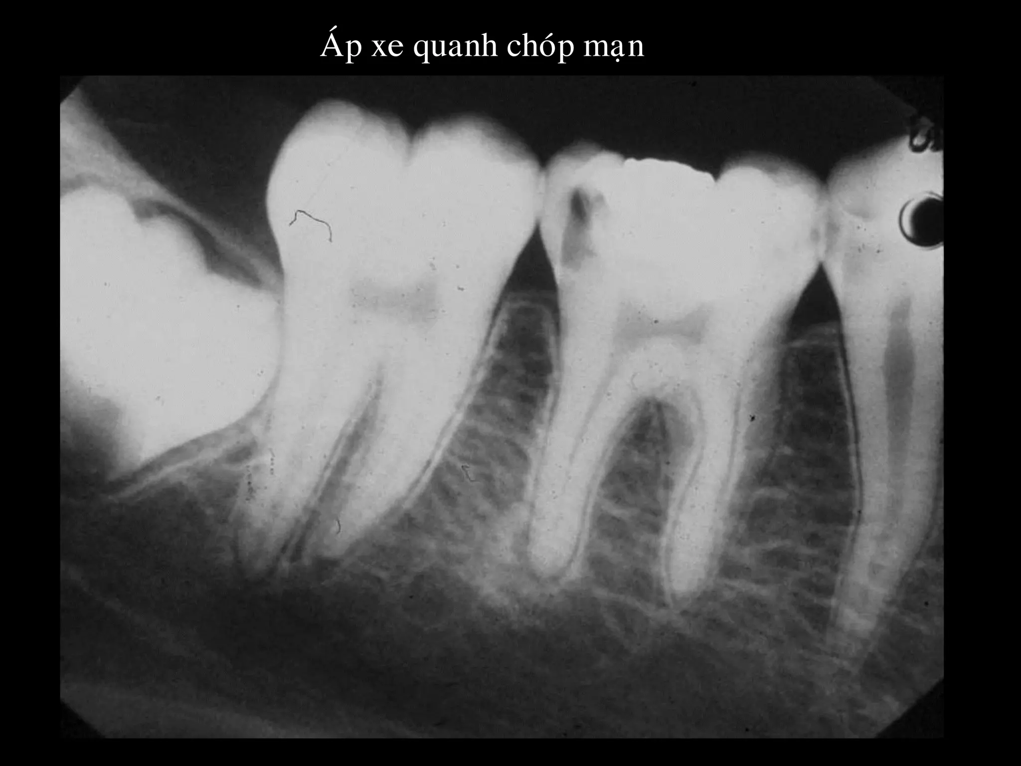 pulpal and periapical pathology. | PDF