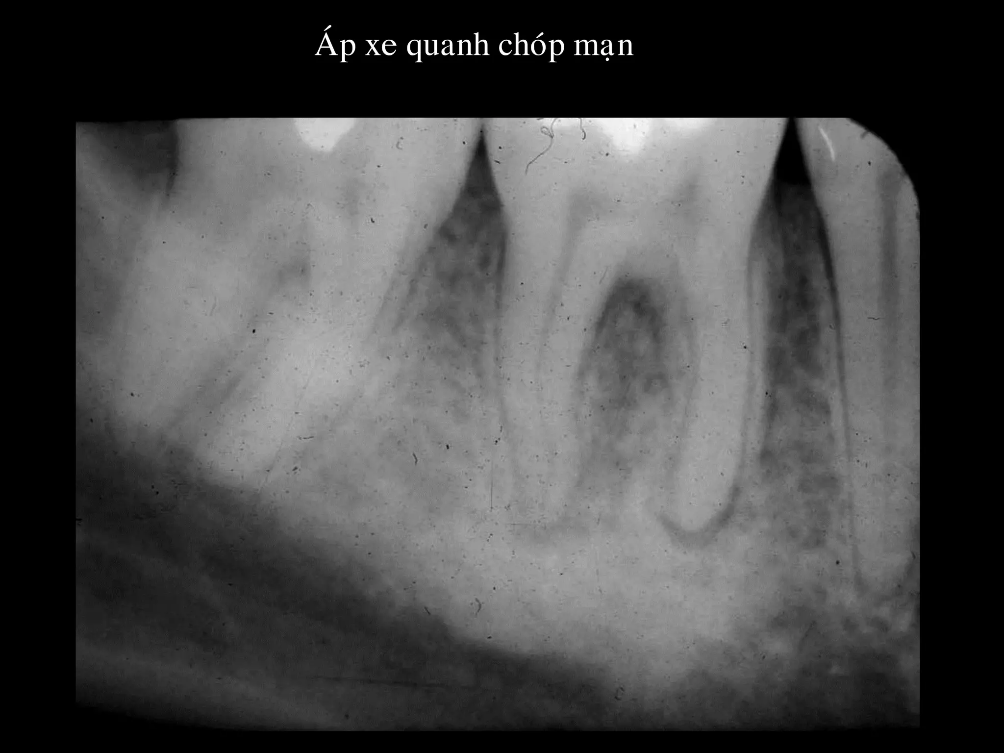 pulpal and periapical pathology. | PDF