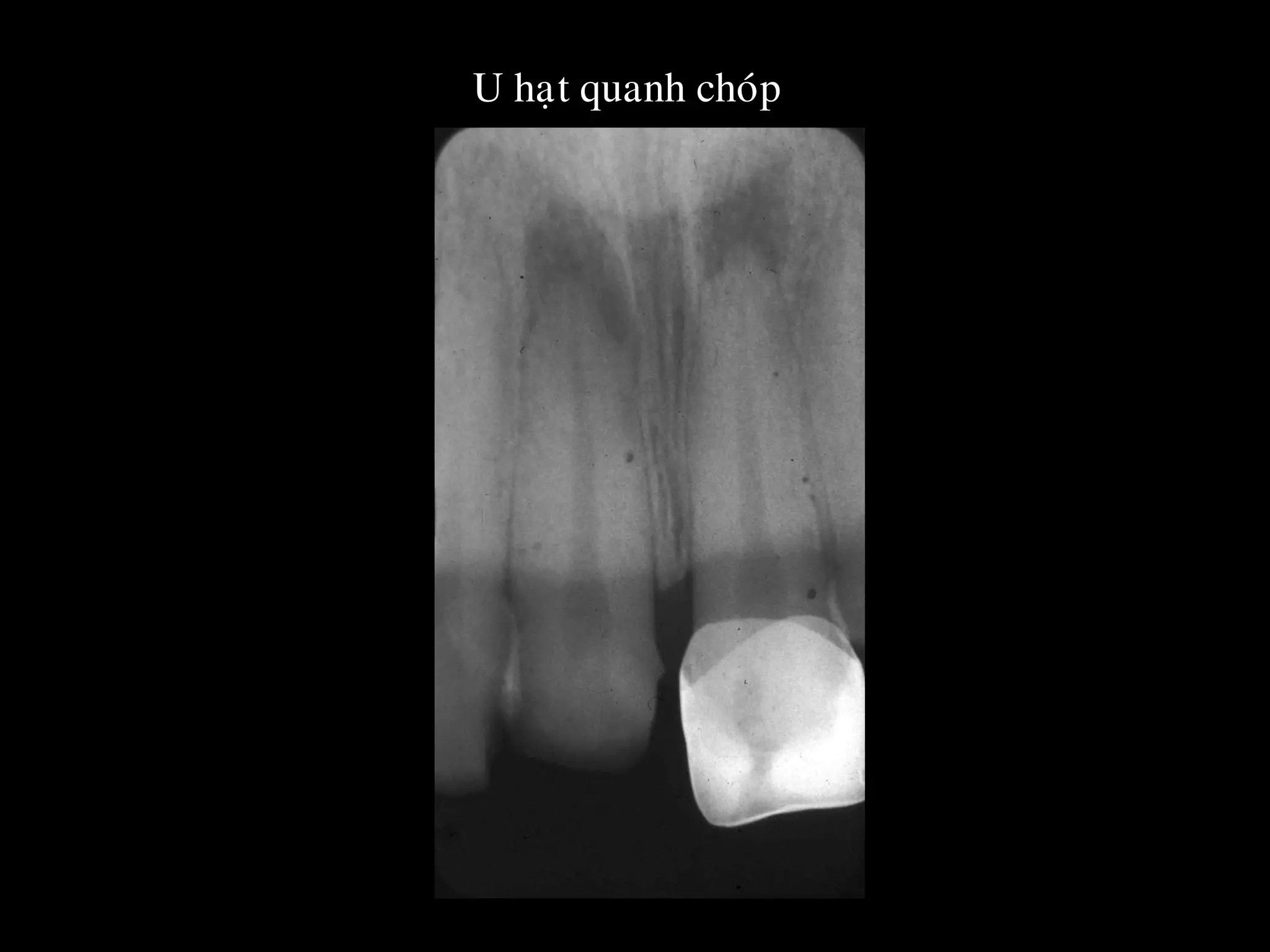 pulpal and periapical pathology. | PDF