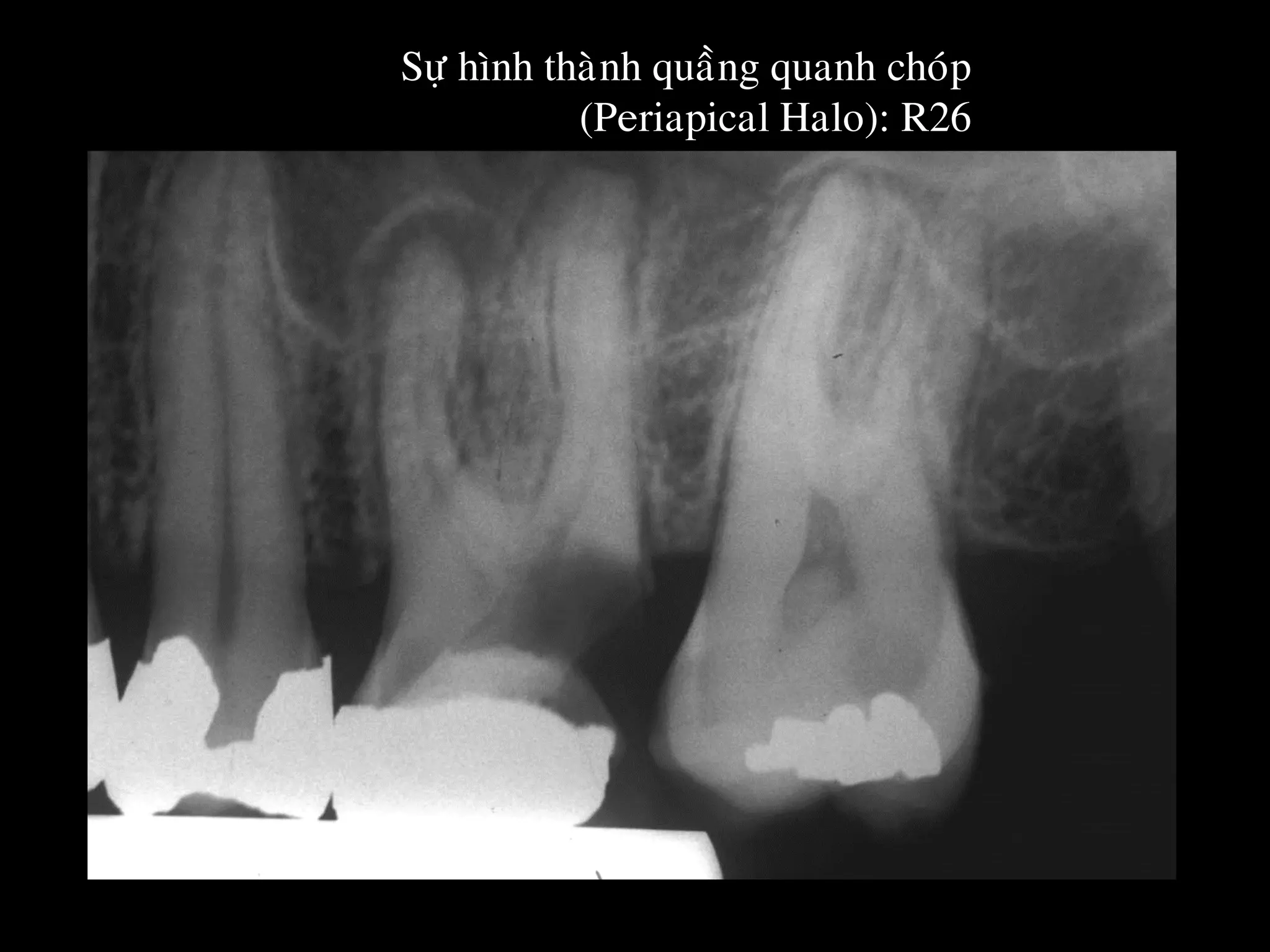 pulpal and periapical pathology. | PDF