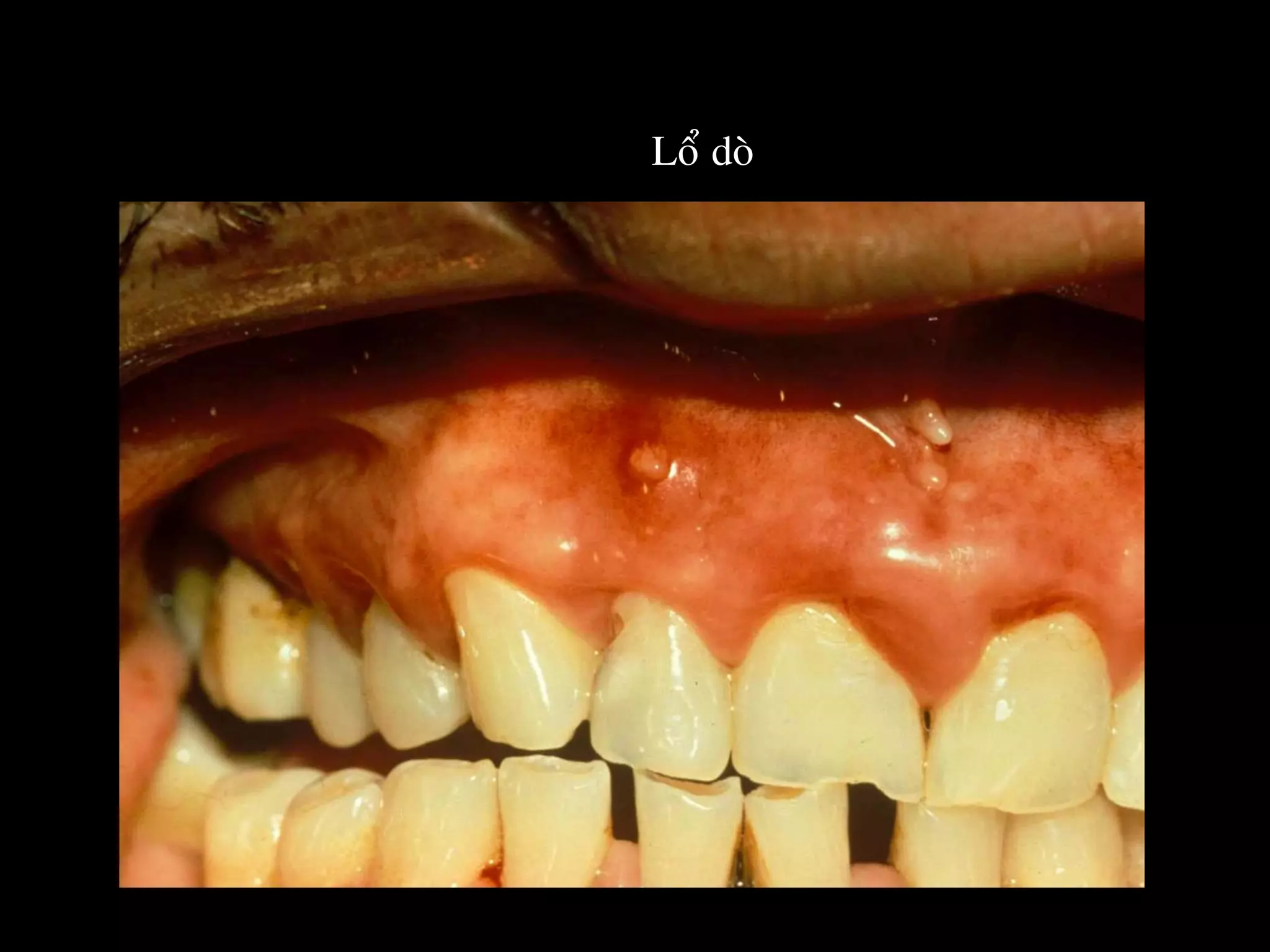 pulpal and periapical pathology. | PDF