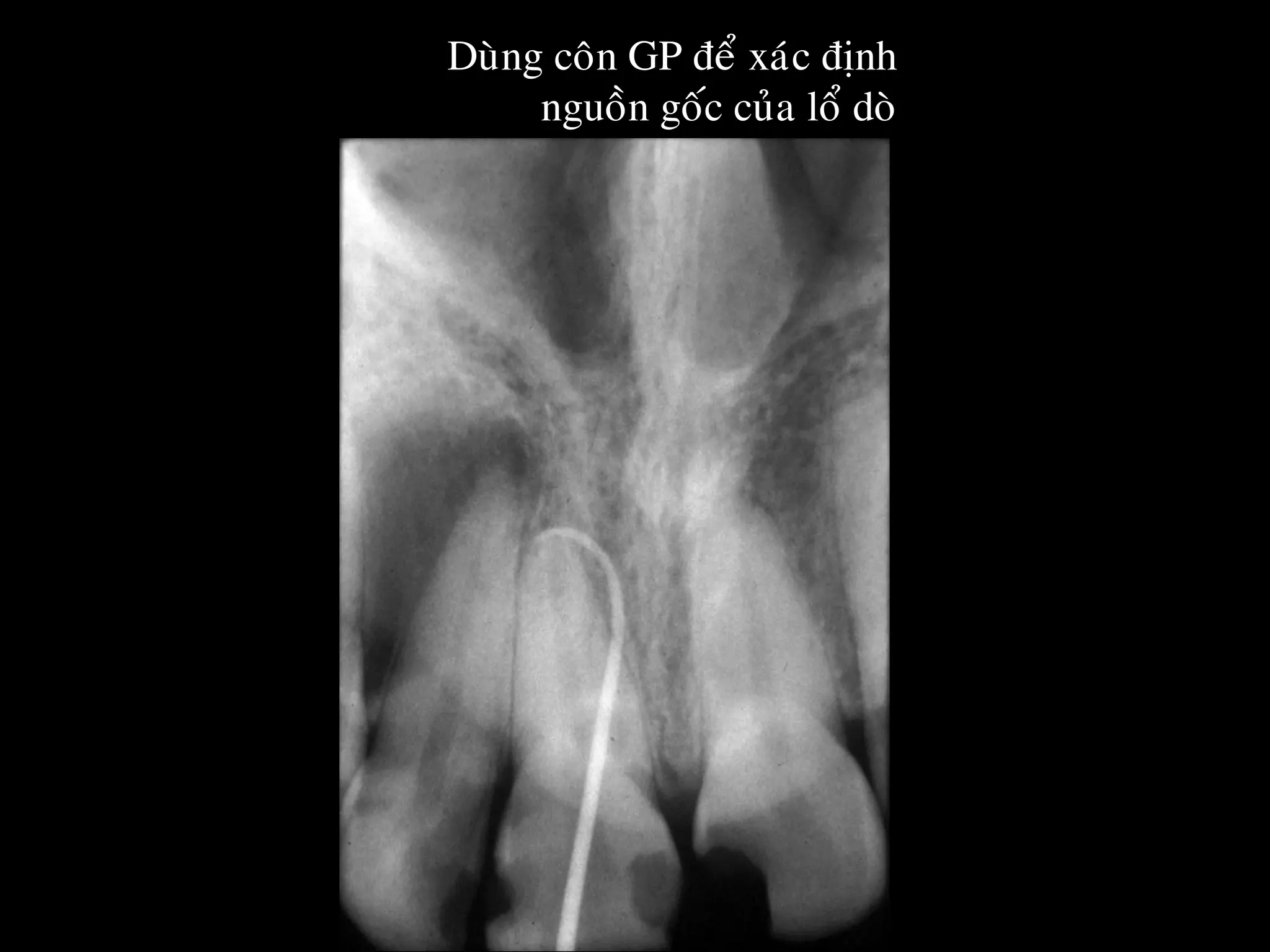 pulpal and periapical pathology. | PDF