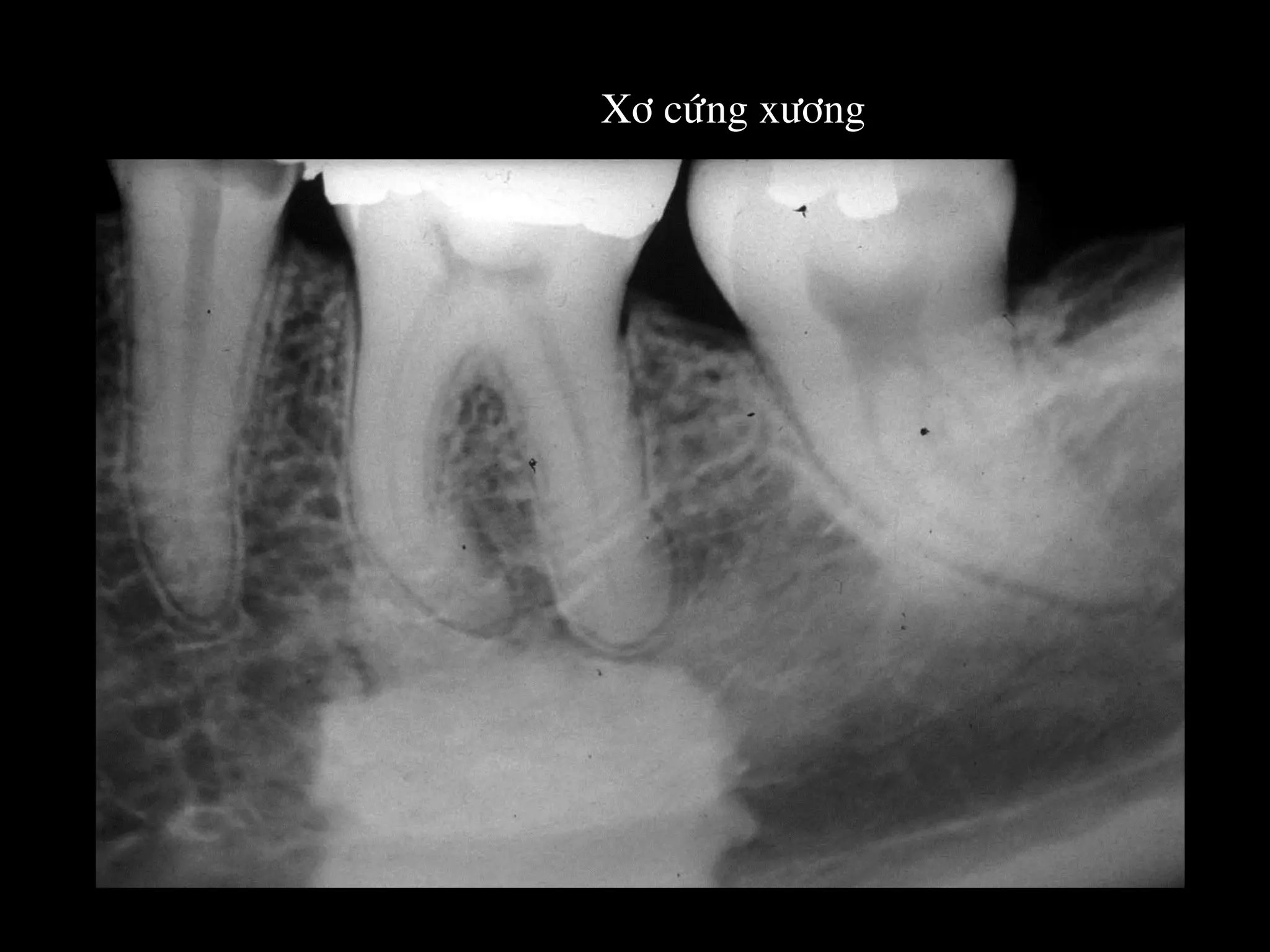 pulpal and periapical pathology. | PDF