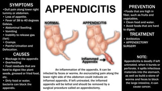 common ailments and disorders of the digestive system | PPTX