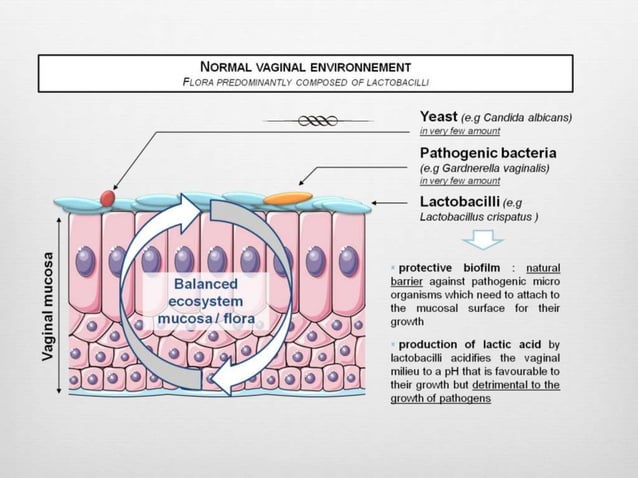 Management of Recurrent UTI in Female | PPT