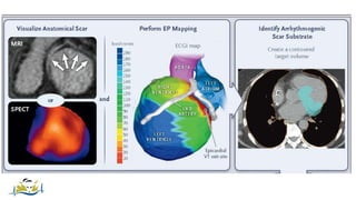Cardiac Electrophysiology: What’s new? by Dr Jonathan Lipton | PPTX