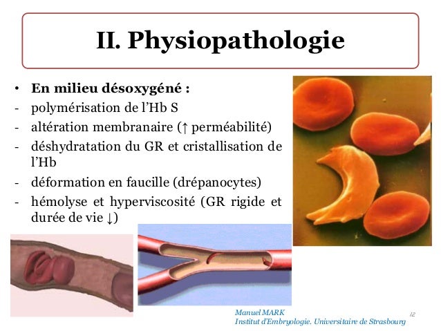 Prise en charge de la drepanocytose chez l'enfant 2016