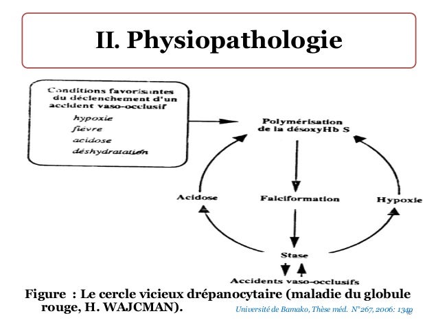 Crise De Drépanocytose – La Drépanocytose Symptômes – EOXPNU