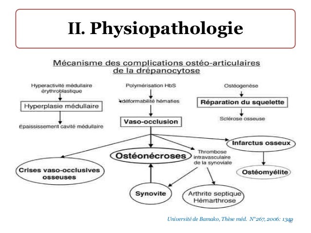 Prise en charge de la drepanocytose chez l'enfant 2016