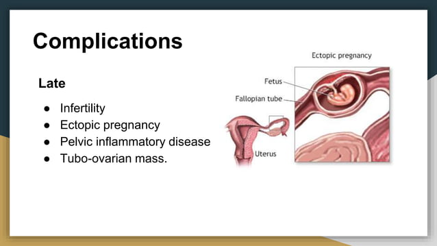 Septic abortion | PPTX