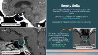 R23_282_Sellar_Region_Pathology_compressed.pdf