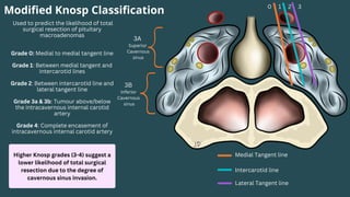 R23_282_Sellar_Region_Pathology_compressed.pdf