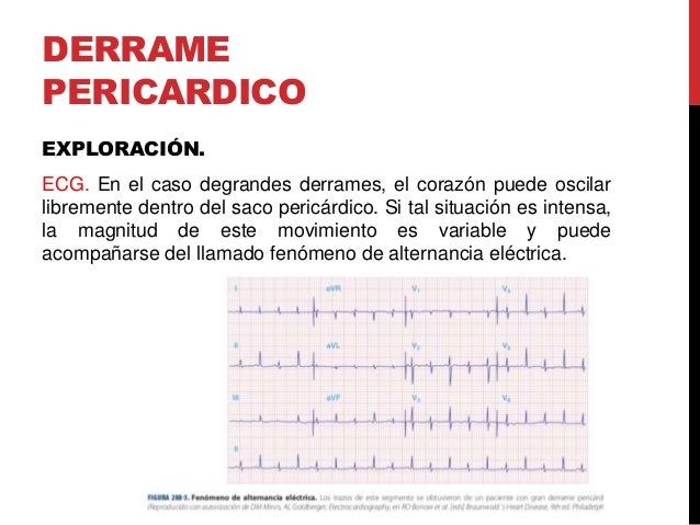 Enfermedades del pericardio