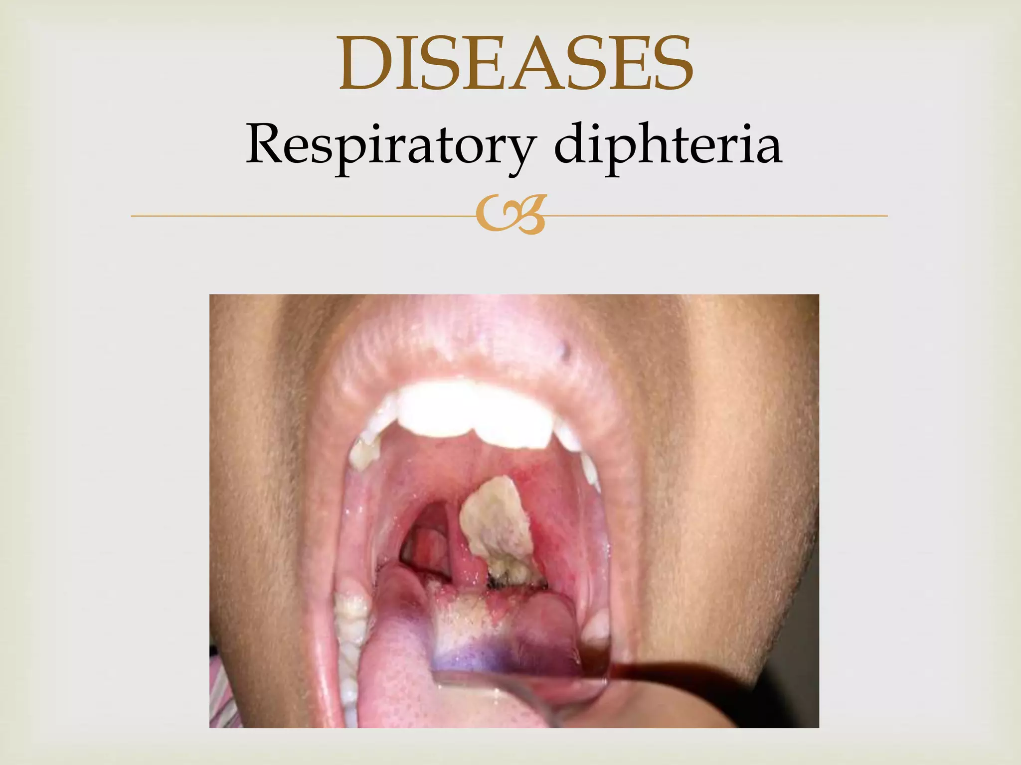 Corynebacterium diphtheriae | PPT