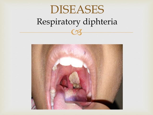 Corynebacterium diphtheriae | PPT | Free Download