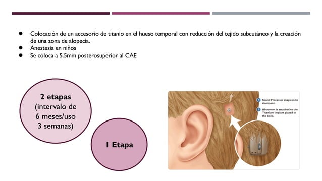 Embriología del oído y atresia del conducto auditivo externo