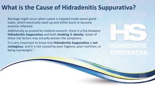 Hidradenitis | PPTX