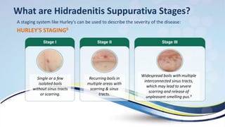 Hidradenitis | PPT