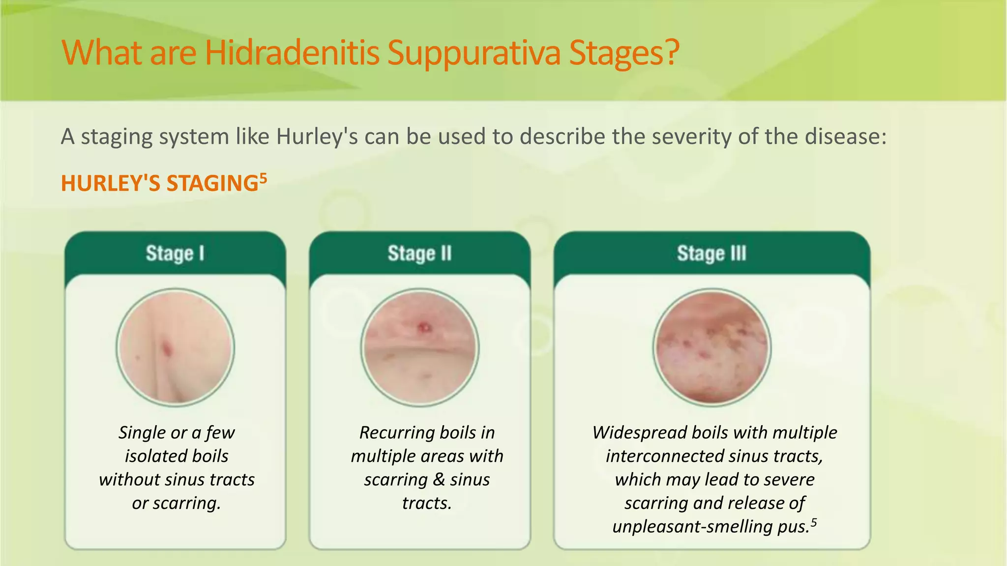 Hidradenitis Suppurativa | PPTX
