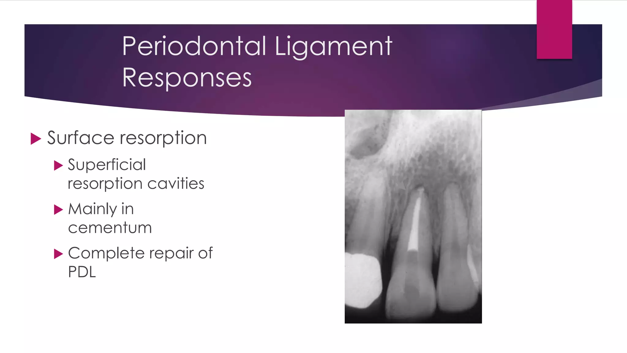 Luxation tooth injuries | PPTX