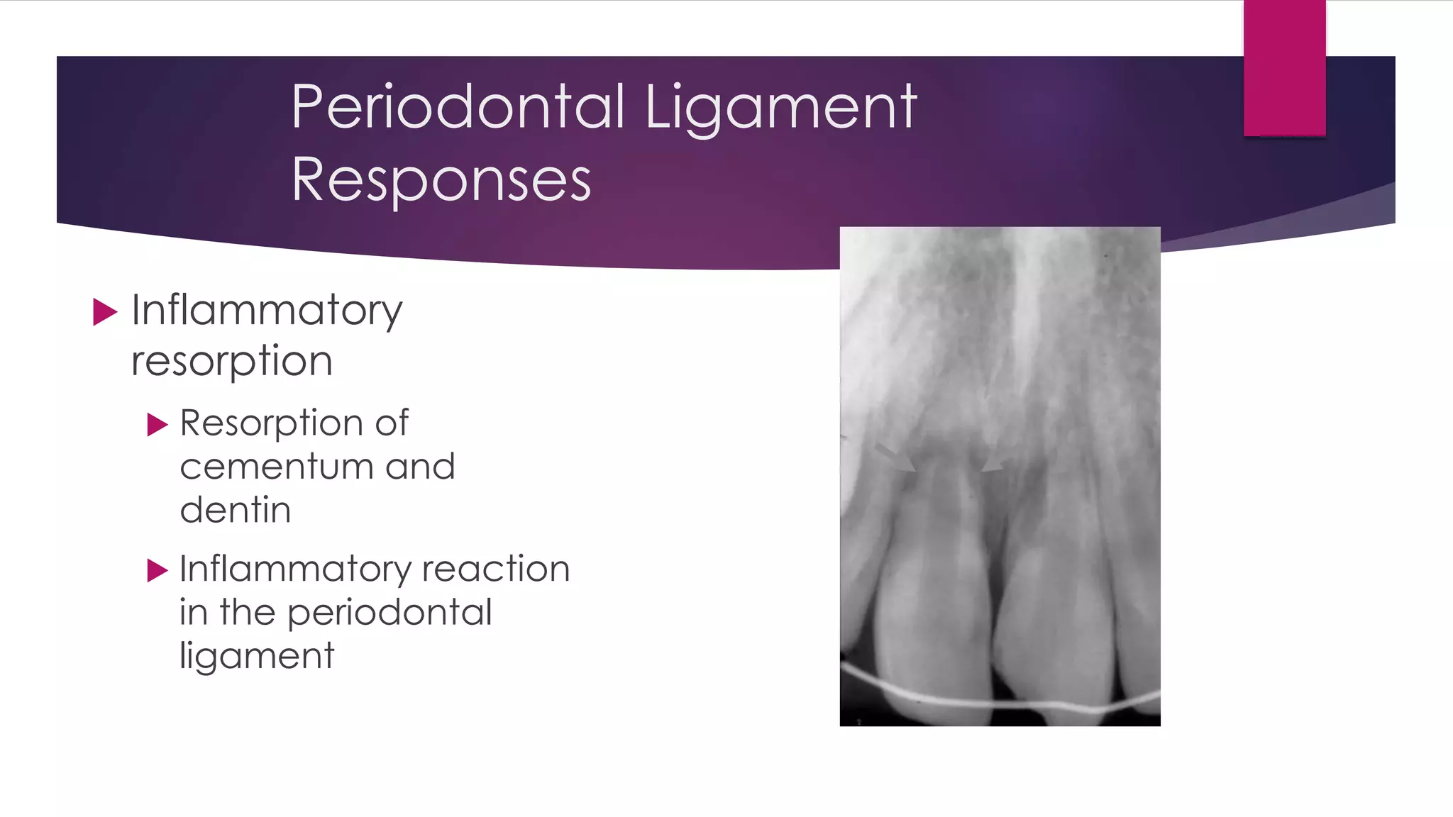 Luxation tooth injuries | PPTX
