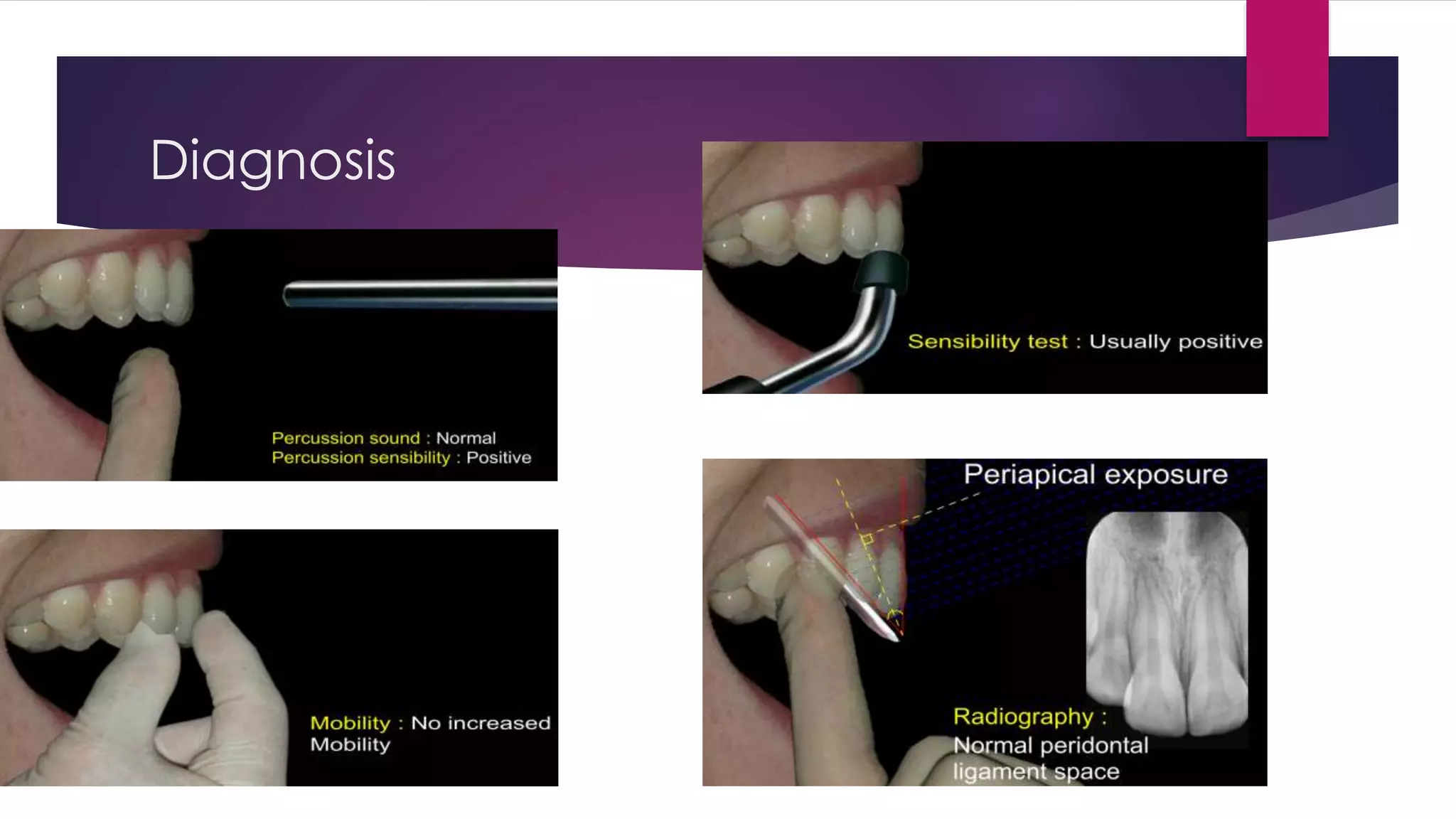 Luxation tooth injuries | PPTX