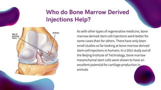 R3 Stem Cell Centers, bone marrow-derived stem cells are injected.pptx ...