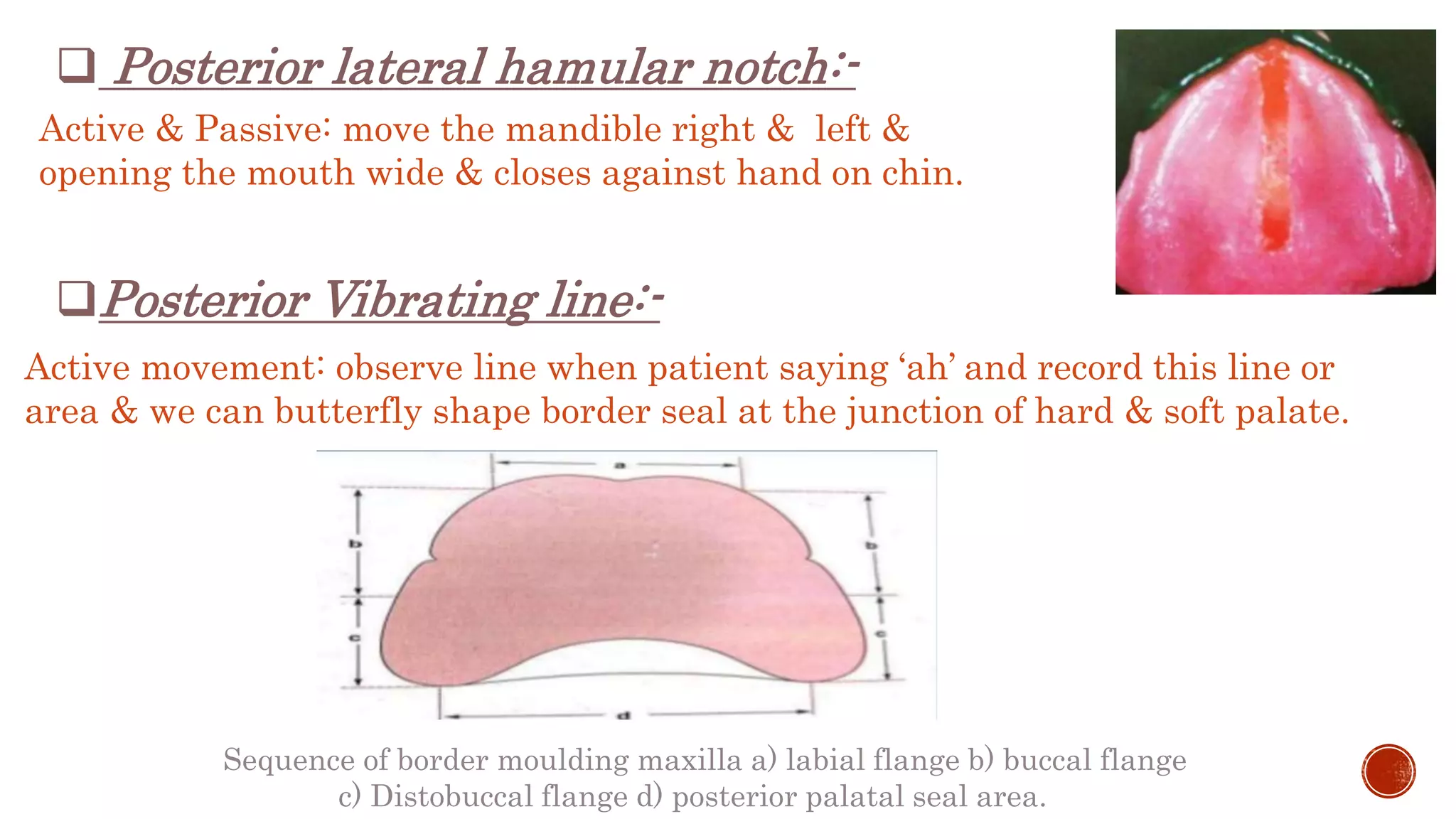 Border Moulding prosthodontics ppt | PPTX