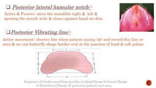 Border Moulding prosthodontics ppt | PPTX
