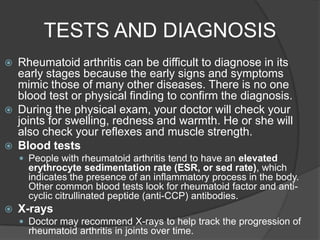 Rheumatoid Arthritis | PPT