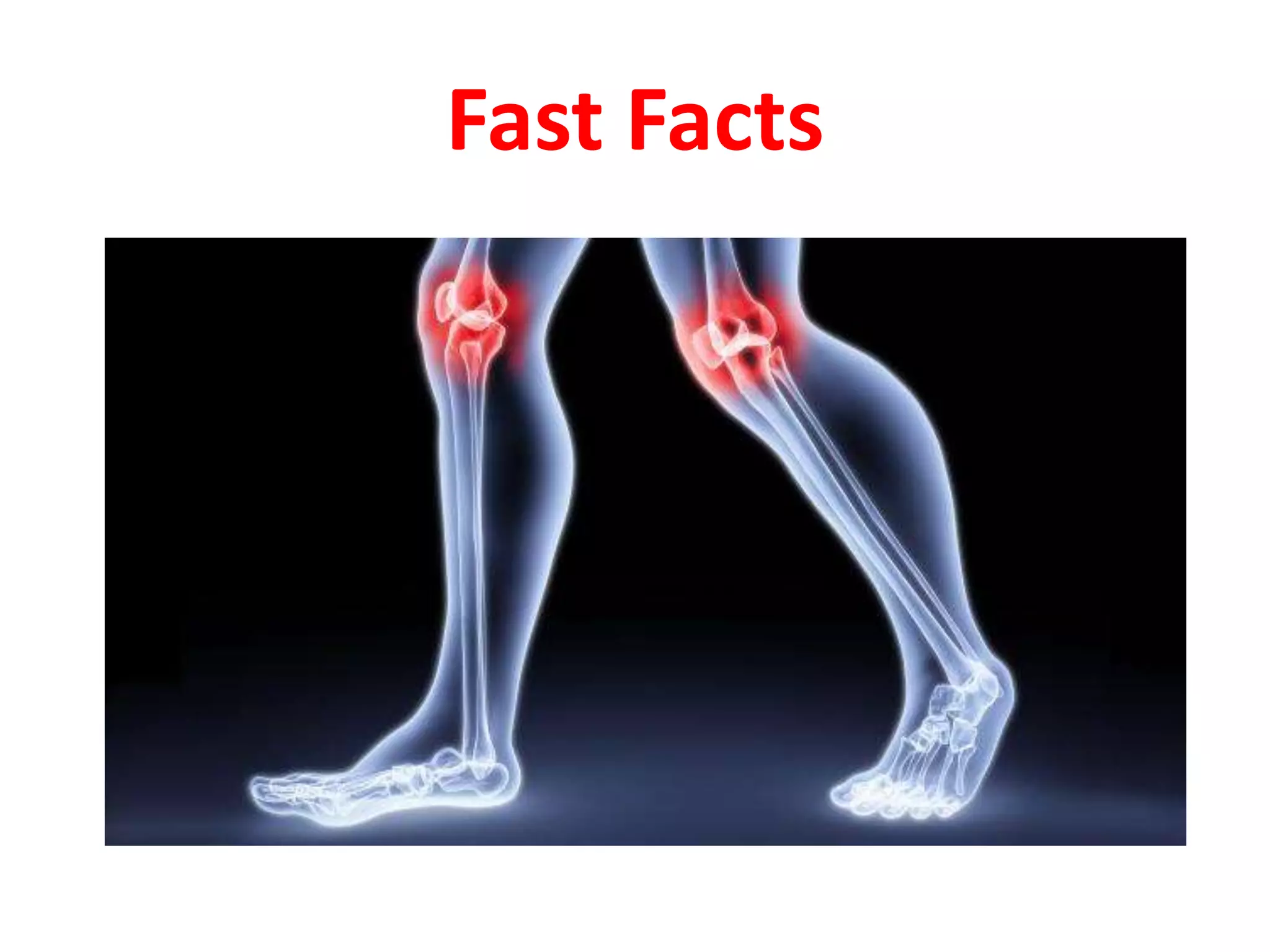 Rheumatoid Arthritis (RA) - Definition, Causes, Symptoms, Treatment and ...