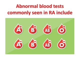 Rheumatoid Arthritis (RA) - Definition, Causes, Symptoms, Treatment and ...