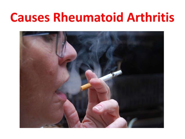 Rheumatoid Arthritis (RA) - Definition, Causes, Symptoms, Treatment and ...