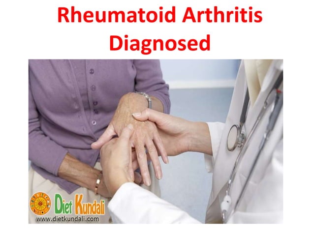 Rheumatoid Arthritis (RA) - Definition, Causes, Symptoms, Treatment and ...