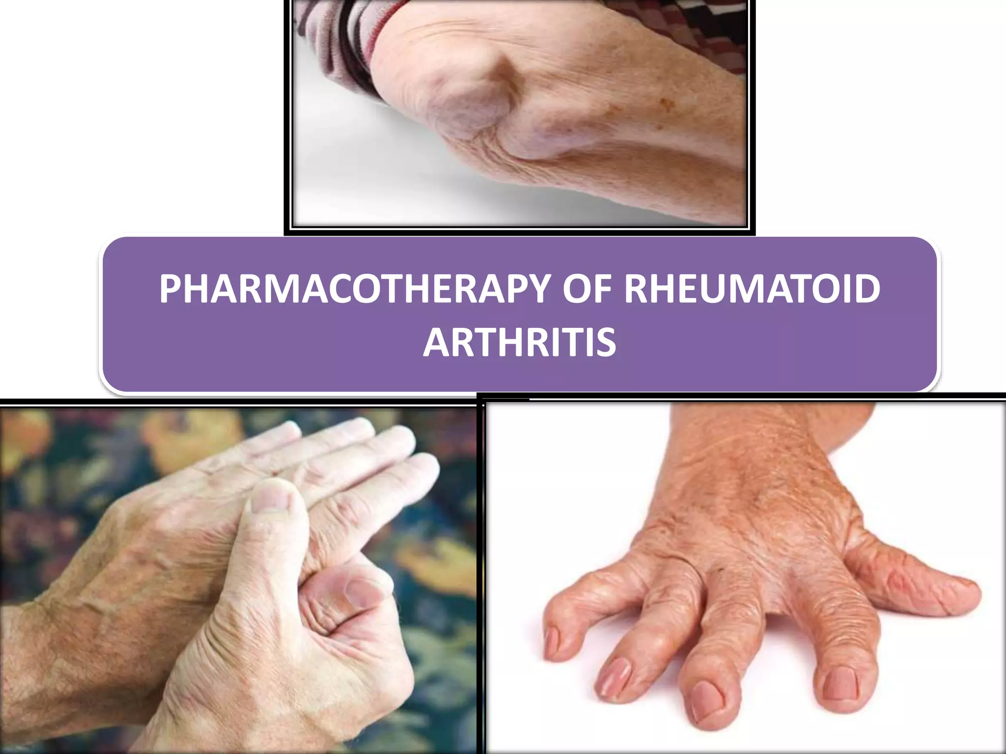 Pharmacotherapy of Rheumatoid arthritis | PPT