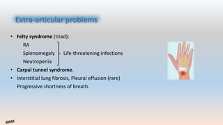 Rhumatoid Arthritis | PPT