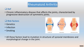 Rhumatoid Arthritis | PPT