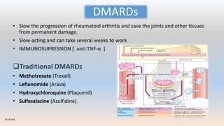Rhumatoid Arthritis | PPT