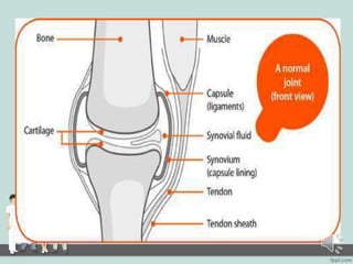 Rheumatoid arthritis Dr. Lamiaa Mohammed | PPT