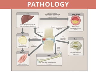 Rheumatoid arthritis clinical presentation pathology pptx | PPTX